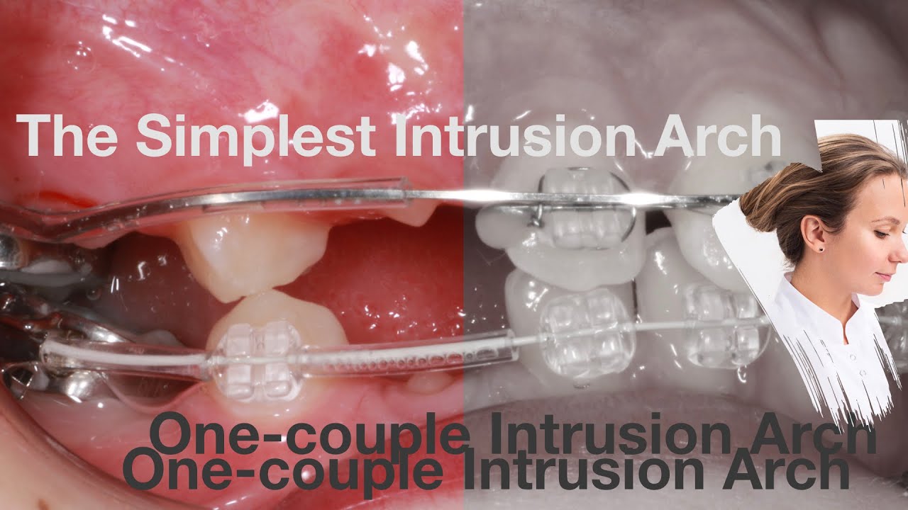 One Couple Intrusion Arch Part 1 YouTube one-couple-intrusion-arch-part-1-youtube