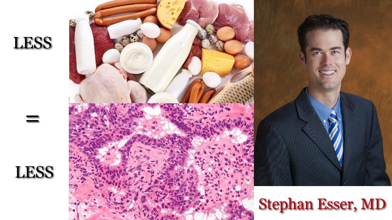 How to Reduce Inflammation | Inflammatory Foods | Stephan Esser, MD ...