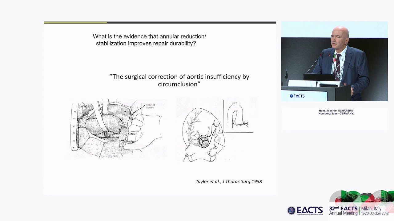 Annuloplasty during Aortic valve repair - YouTube