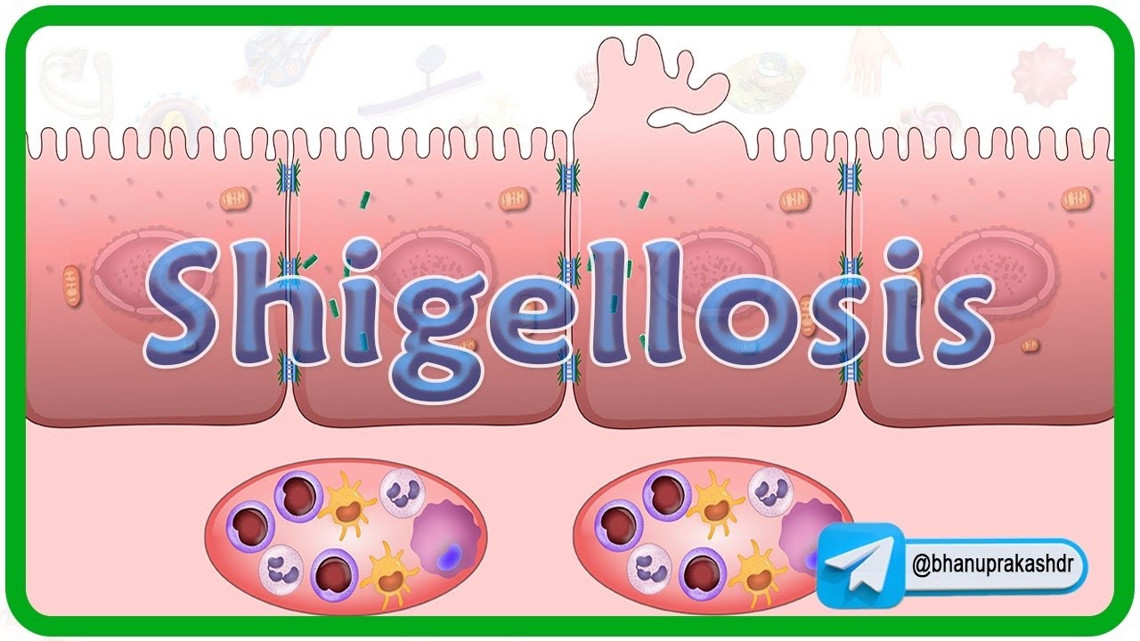 Shigellosis Microbiology Animation : Pathogenesis, Clinical ...