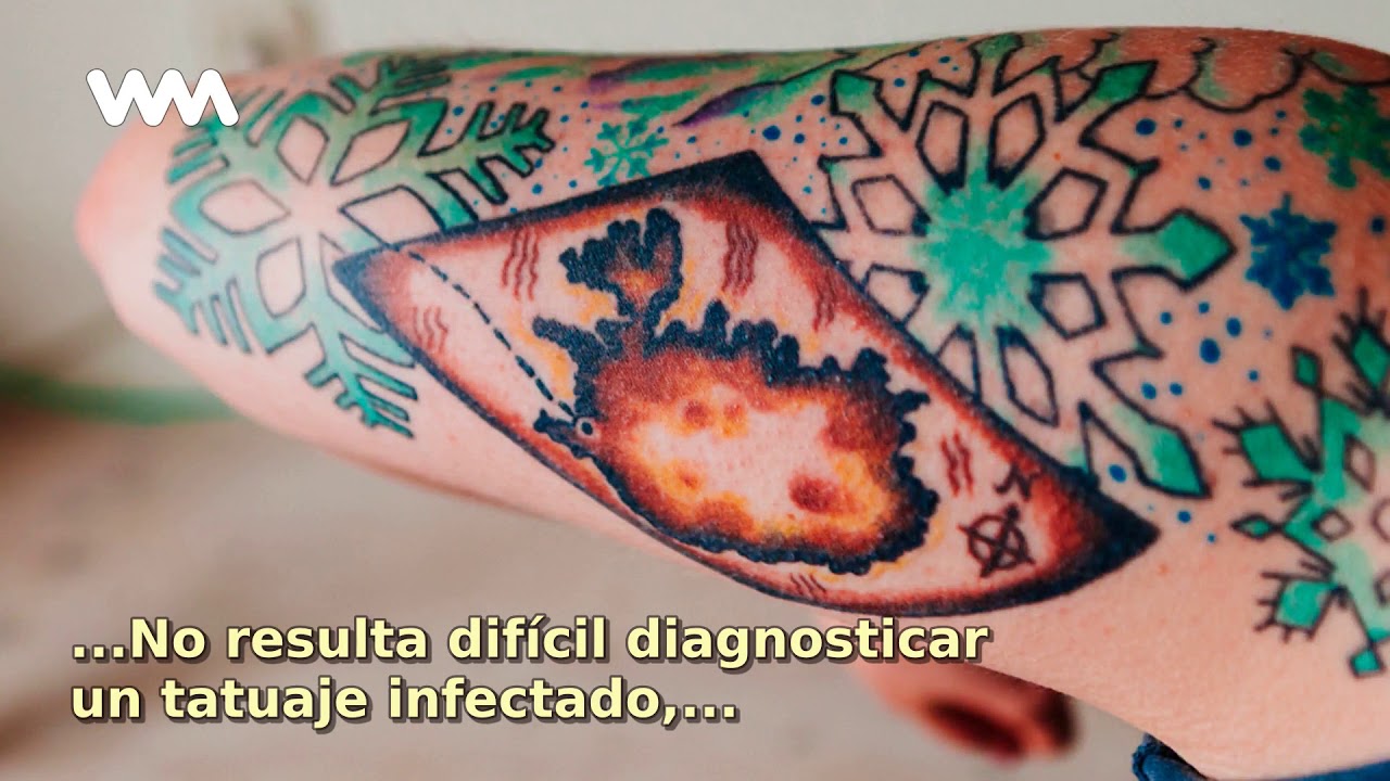 ¿Cuáles son los síntomas de un tatuaje infectado? - YouTube