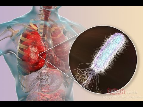 Kistoz Fibroz xəstəliyi ilə mübarizə-Səadət Bayramova - YouTube