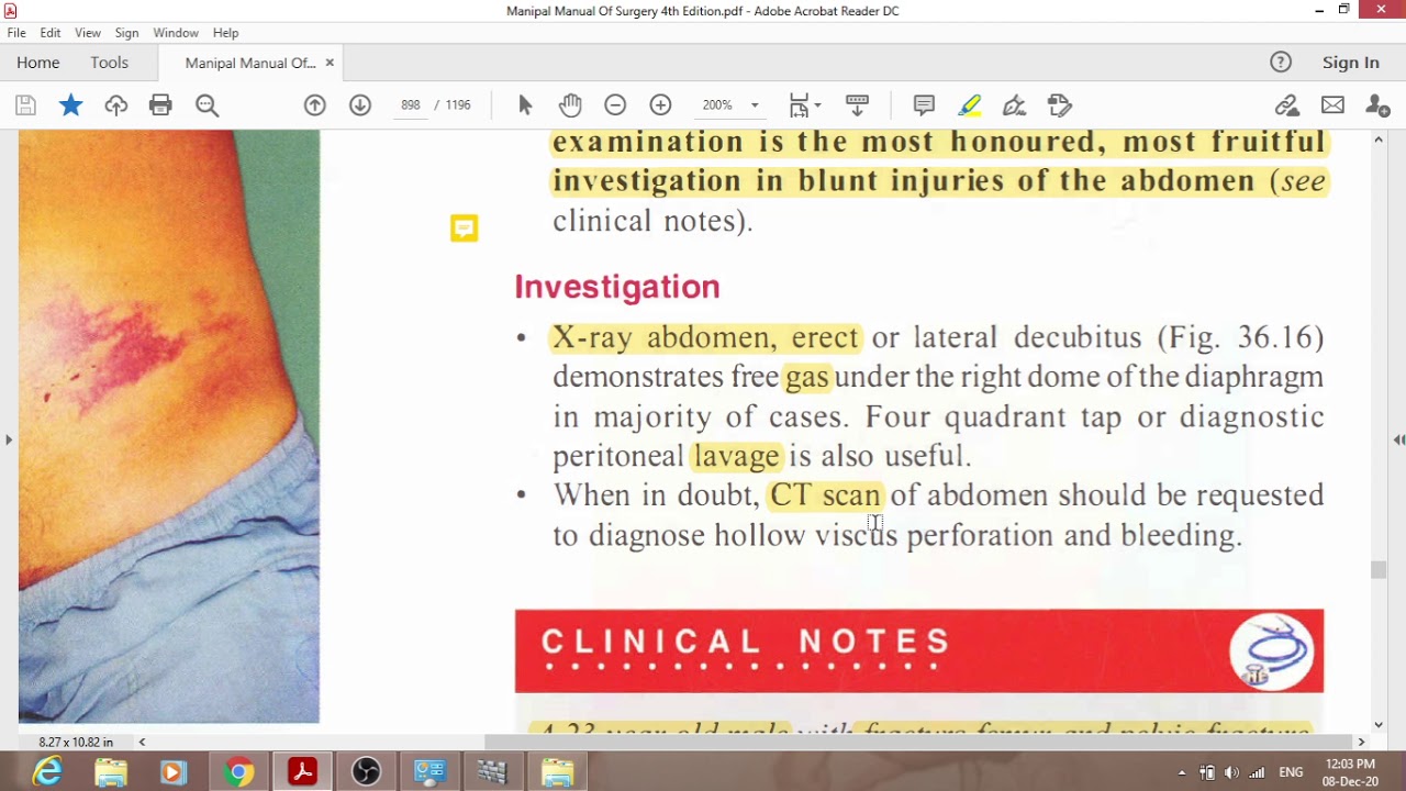 Dr Baki, small intestine injuries - YouTube