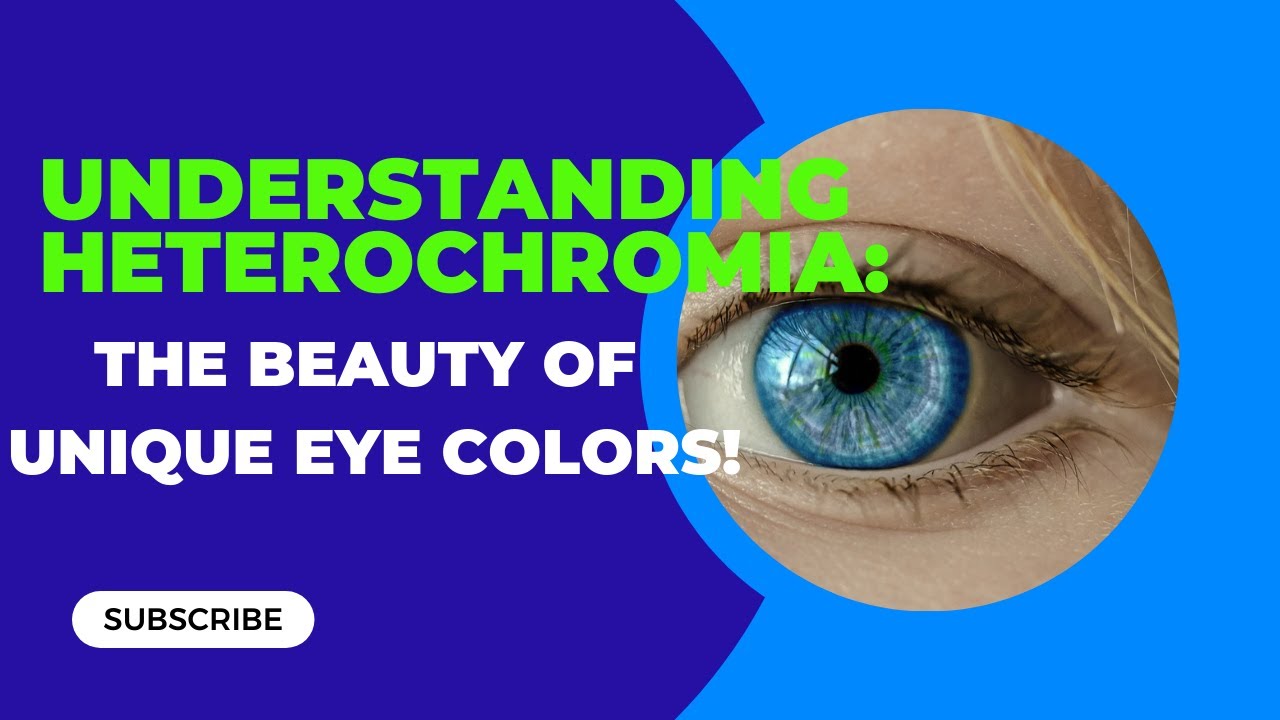 Understanding Heterochromia: The Beauty of Unique Eye Colors! - YouTube