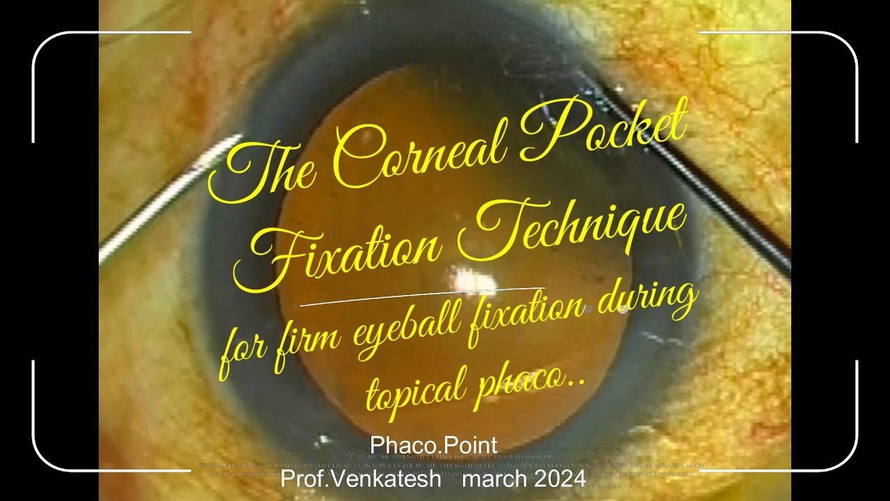 The Corneal Pocket Fixation Technique - for firm eyeball fixation ...