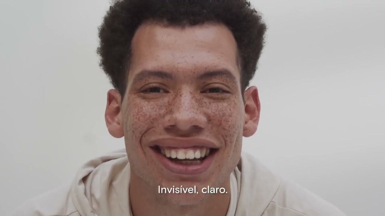 Aparelho Invisível: Como funciona SouSmile - YouTube