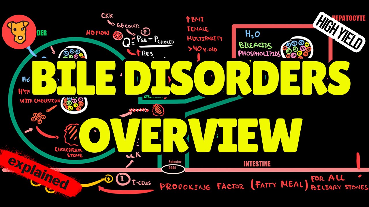 Biliary Disorders EXPLAINED: Overview, Diagnosis & Management (USMLE ...