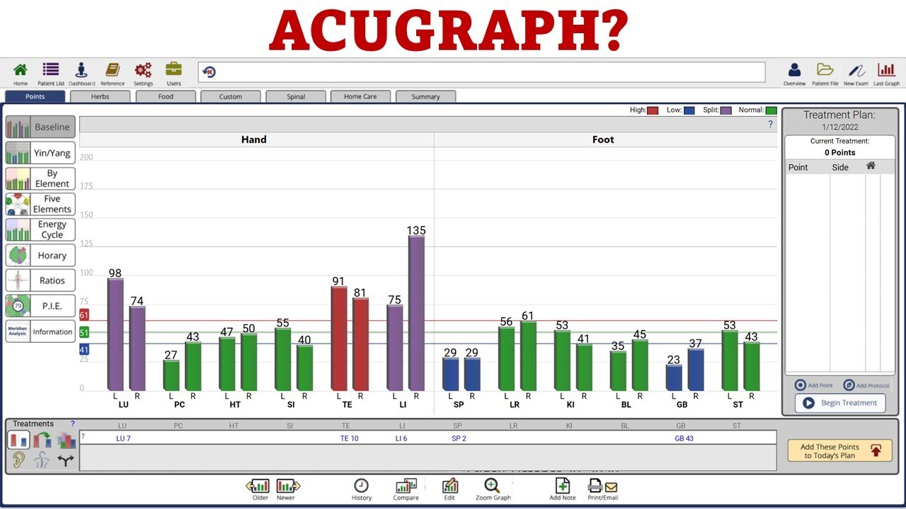 The AcuGraph Electrical Health Exam - YouTube