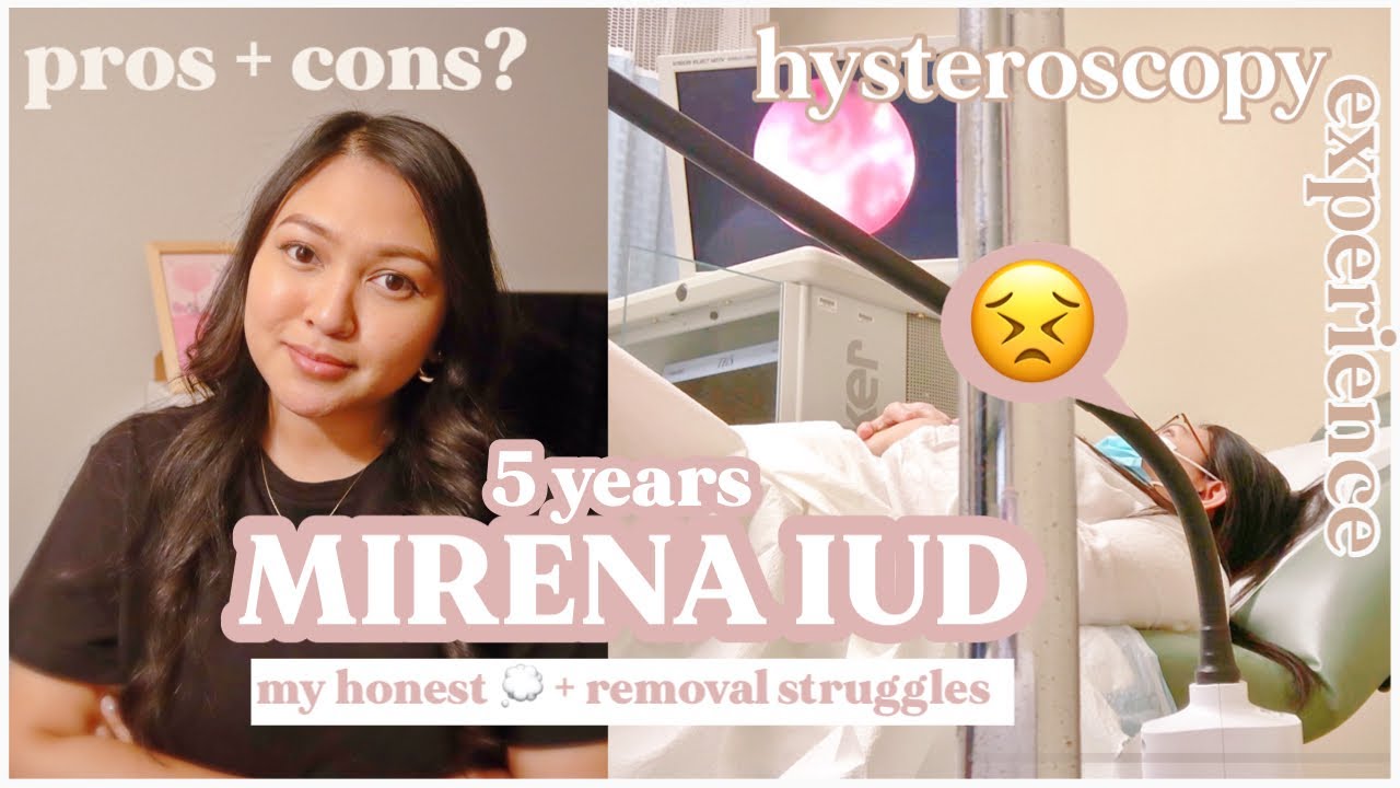 Mirena Five years Birth Control IUD Honest Experience + HYSTEROSCOPY ...