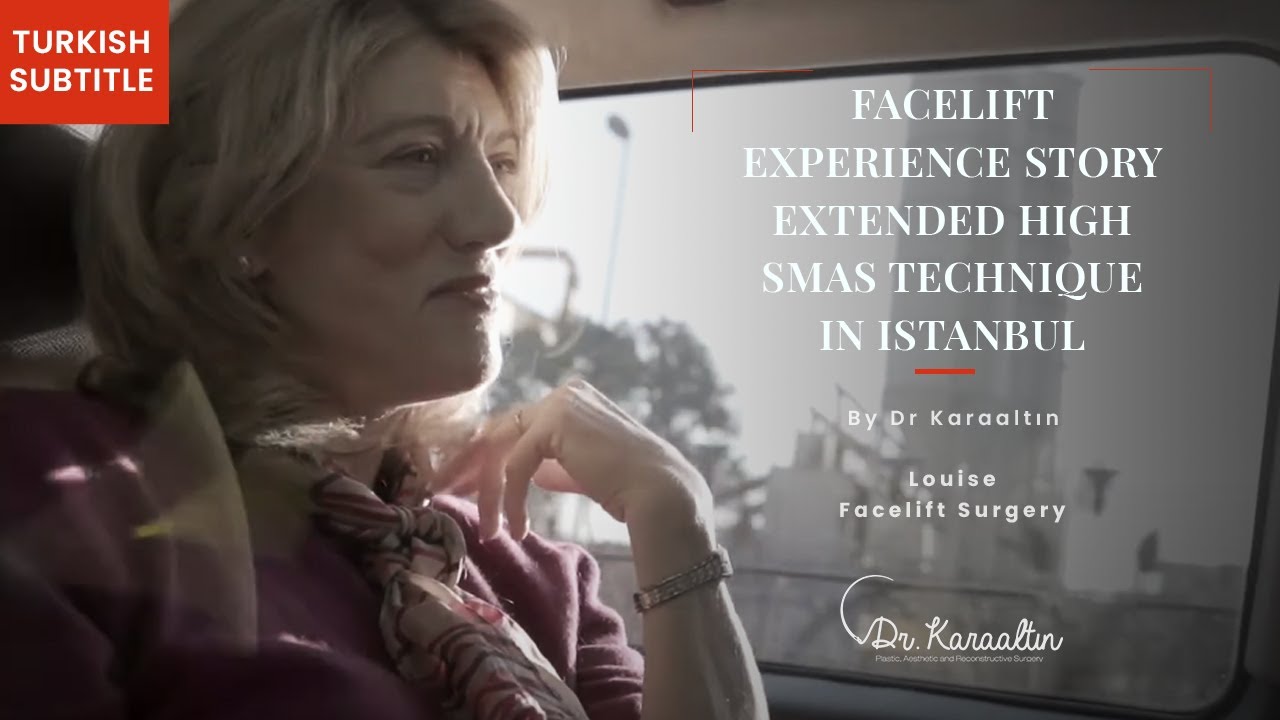 Facelift Experience Story - Extended High SMAS Technique in Istanbul ...