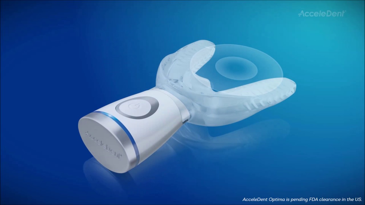 Introducing AcceleDent® Optima™ - YouTube