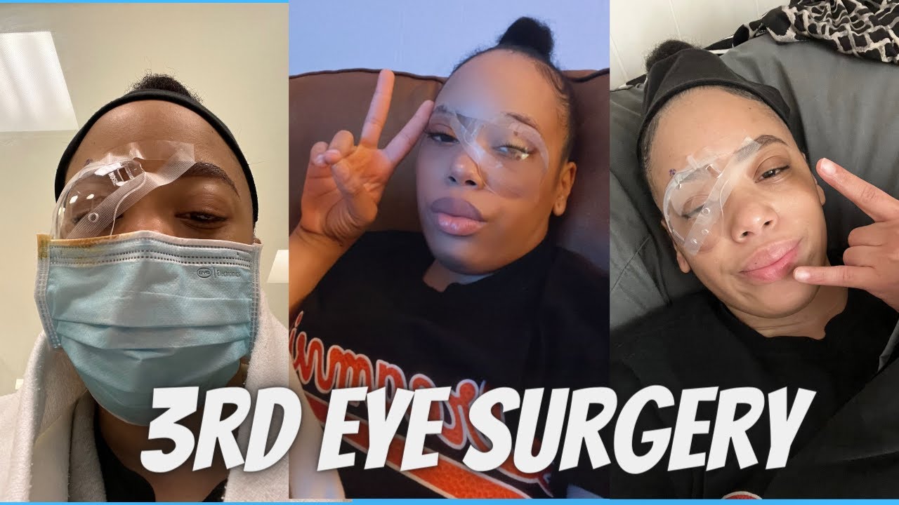 A THIRD EYE SURGERY?! | CATARACT EYE SURGERY - YouTube