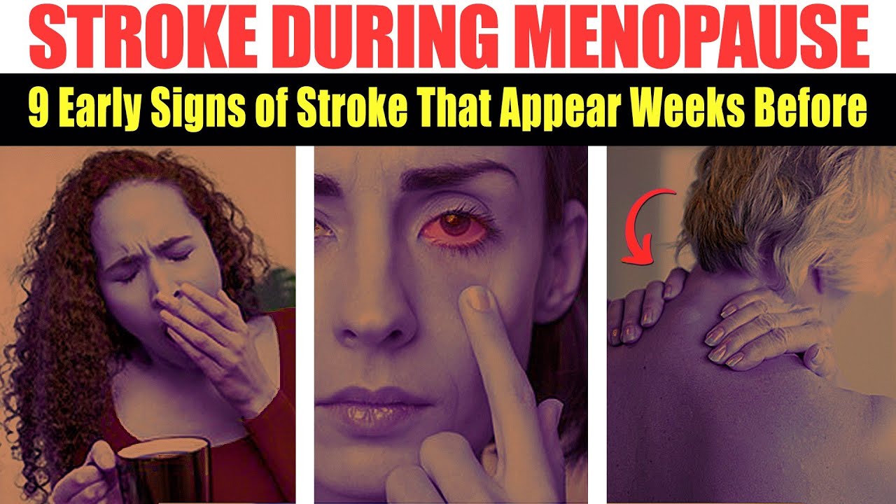 9 Early Signs of a Menopausal Stroke (Appear 1 Week Before) - YouTube
