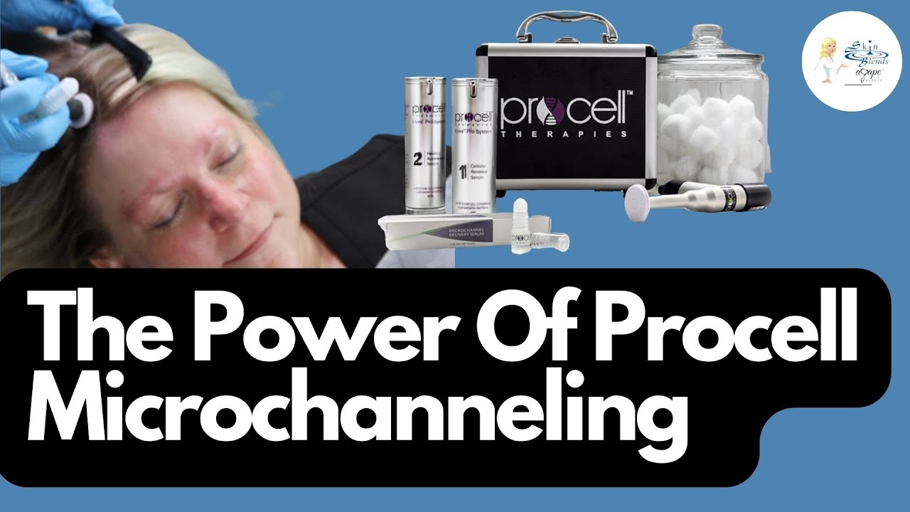 Procell Microchanneling Live Demonstration - YouTube