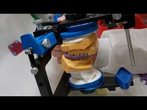 Verifying Accuracy of Mounted Casts on Articulator - Dr. Mark R. Taylor ...