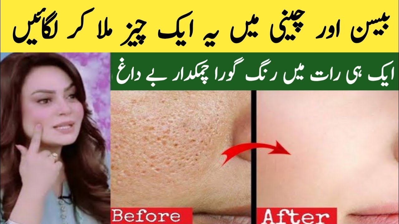 "Instant Glow with Besan Face Pack | DIY Skin Whitening Face Wash ...