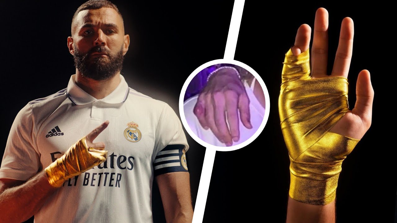 ¿Porque Karim Benzema lleva una venda en la mano? / su terrible lesión ...