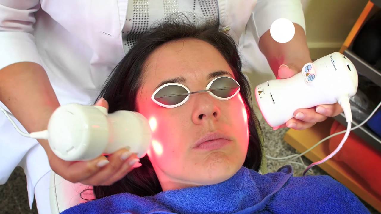Byonik Laser Behandlung von Spürbarschön Aschaffenburg - YouTube