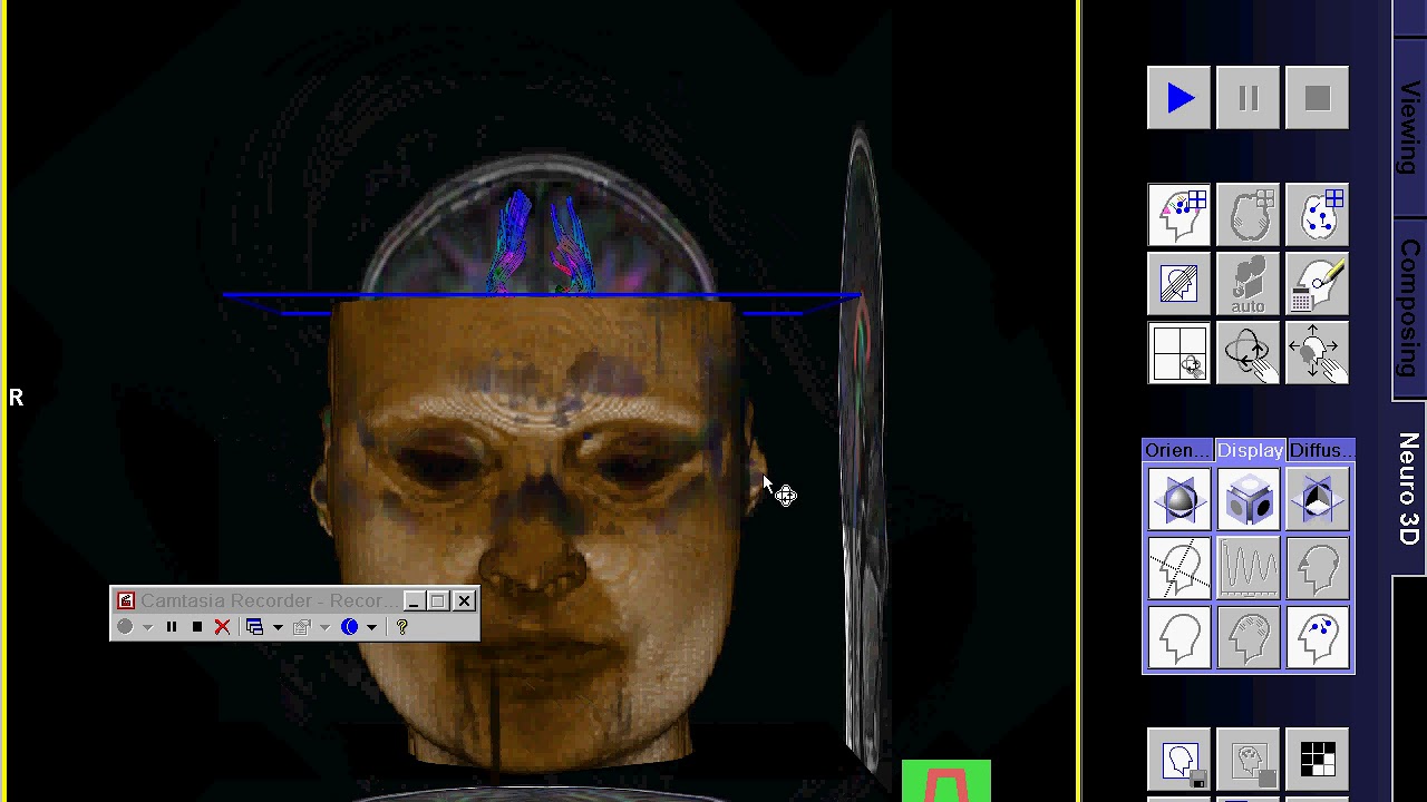 DTI Task card Siemens - YouTube