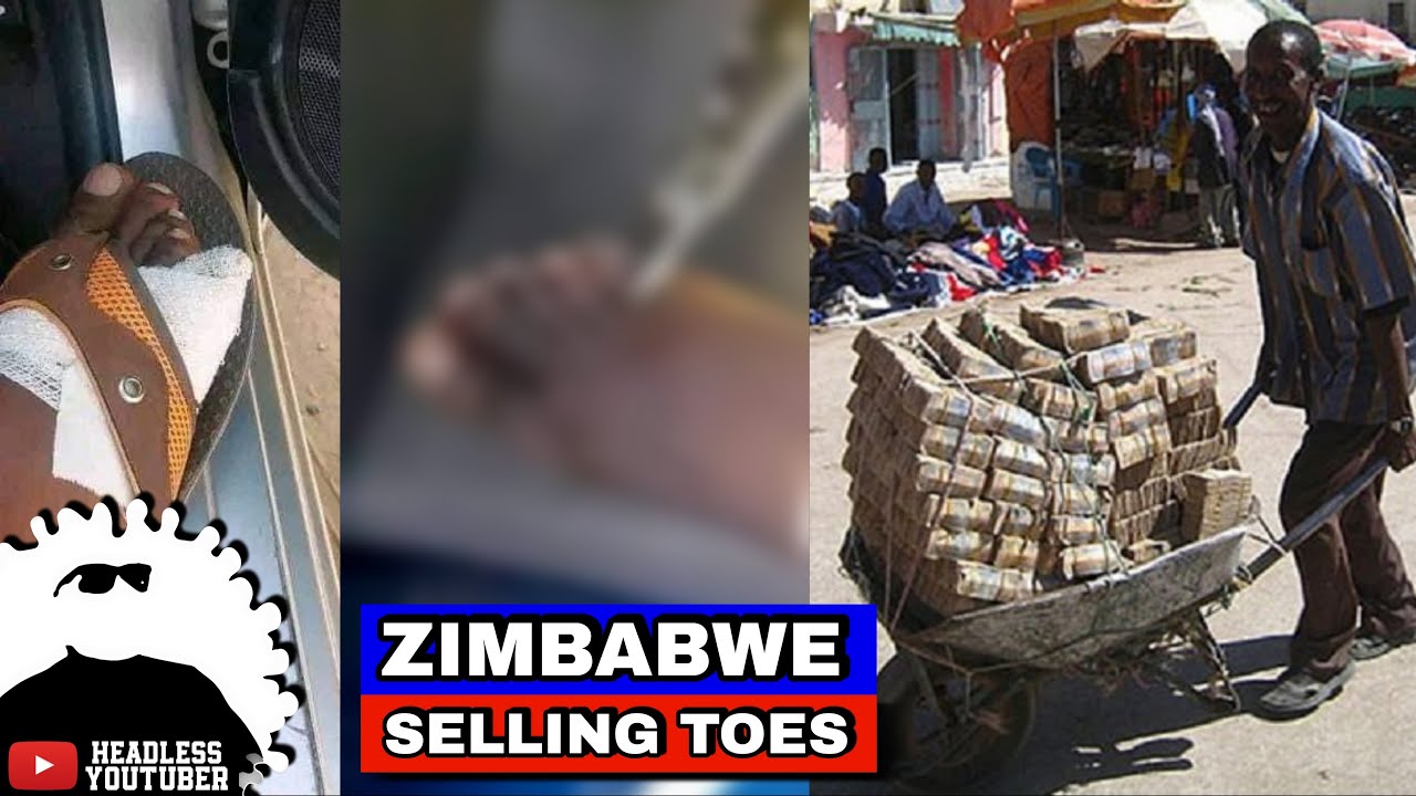 What's happening in Zimbabwe is crāzy! People are Selling their Toes ...