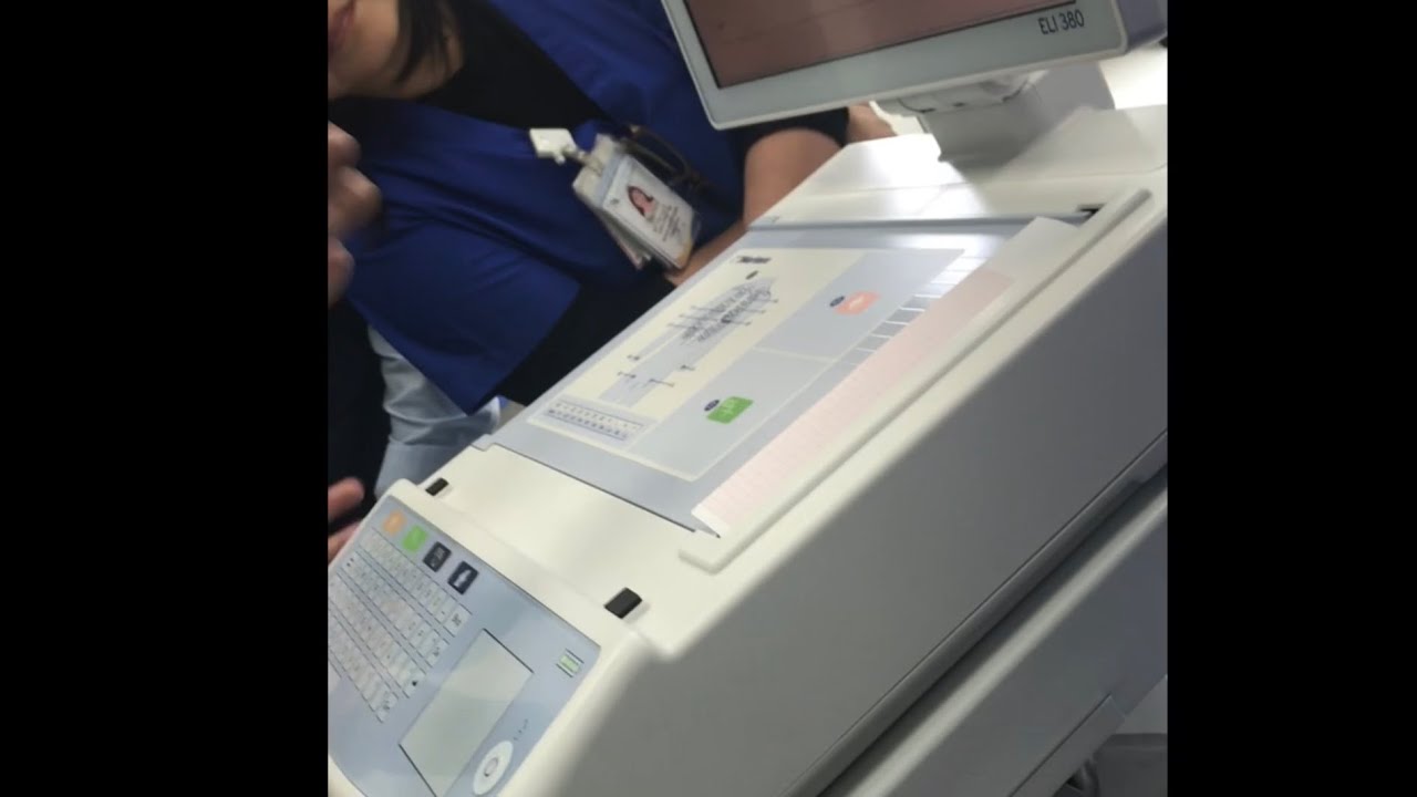 Mortara ECG Machine || LEARN THE BASIC || - YouTube