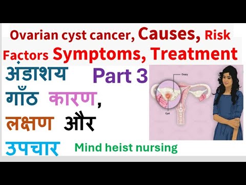 Ovarian cyst cancer, Causes, Risk Factors Symptoms, Treatment Part 3 ...