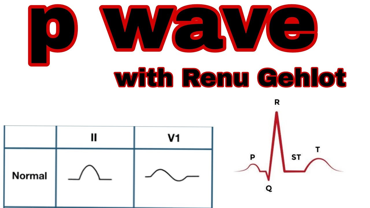 P wave || Interpretation of p wave || Normal p wave.... - YouTube