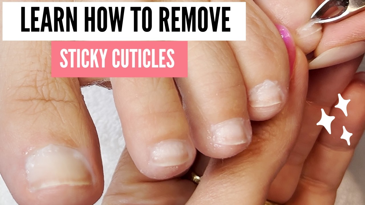 Learn How To Heal Ingrown Toenail at Home: PedicureTutorial and Sticky ...