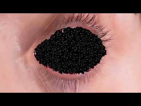 ASMR Animation Treatment Infected Eye | 2D ASMR Animation - YouTube