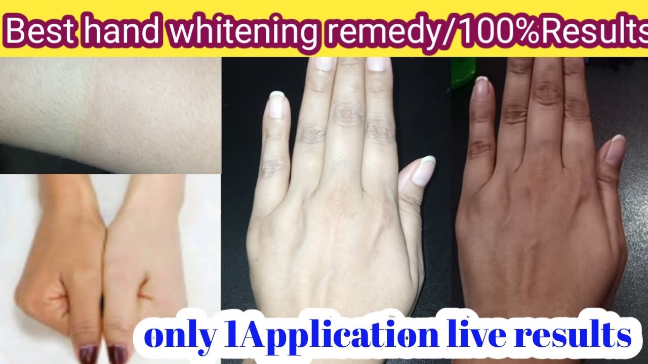 Hands whitening remedy live results,only 1 Application 100%results😳 ...