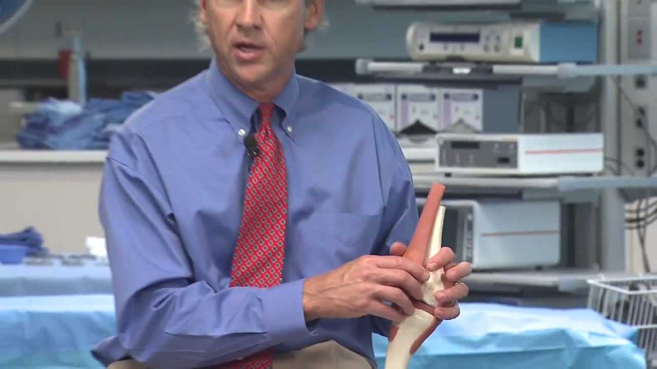Patella instability - Dr. Stephen Geary - YouTube