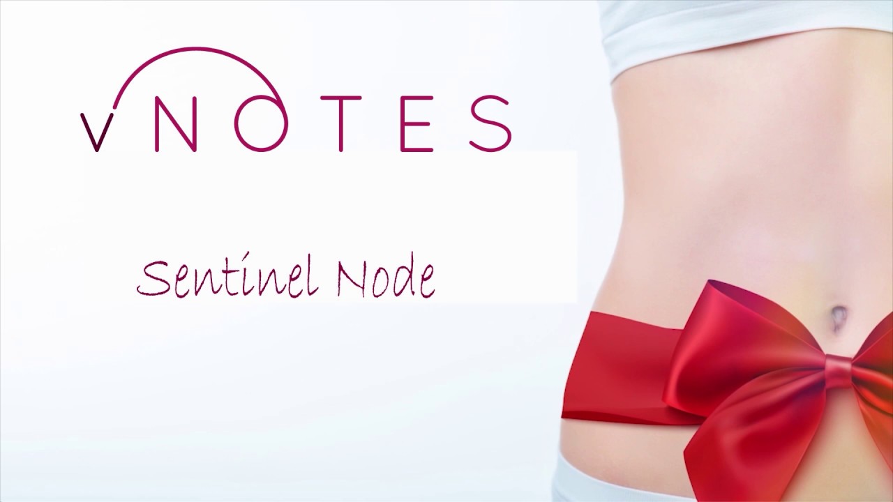 vNOTES Retroperitoneal Sentinel Node Resection - YouTube