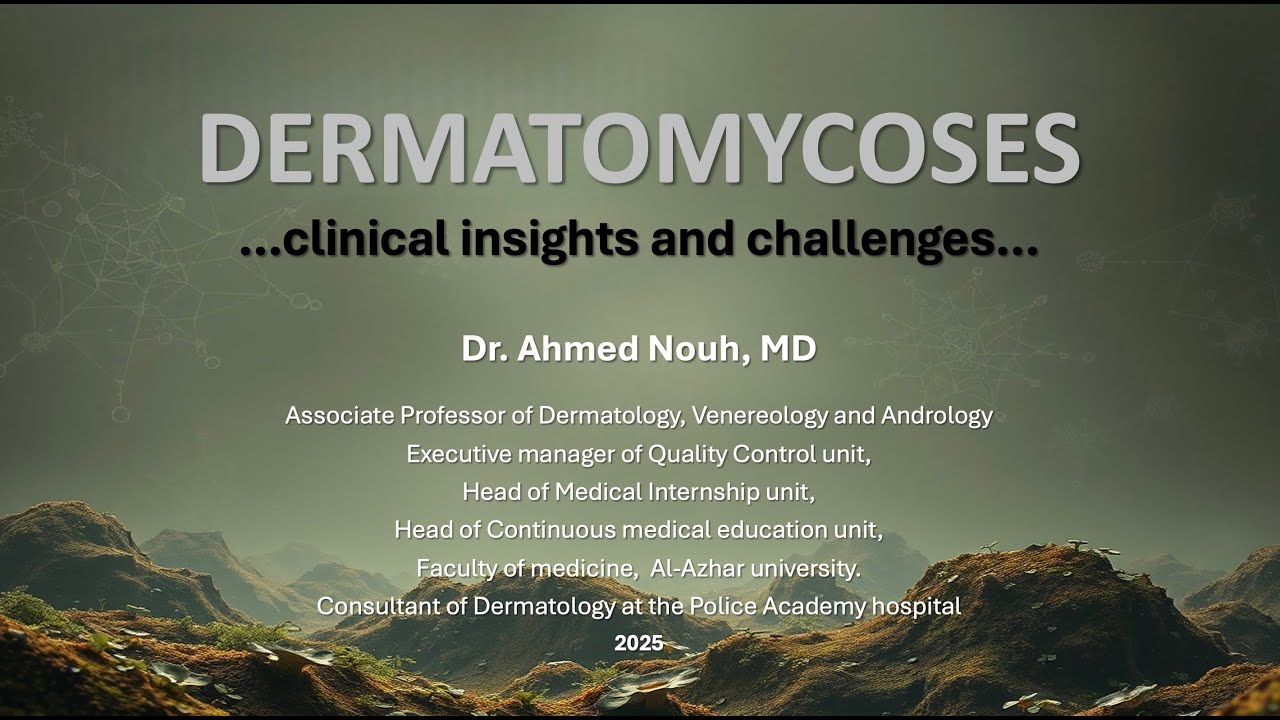 Dermatomycosis: Clinical insights and challenges - YouTube