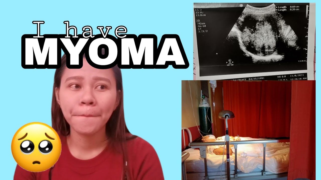 #myoma #myomectomy My Myoma Journey || Bukol sa matres || Myoma ...