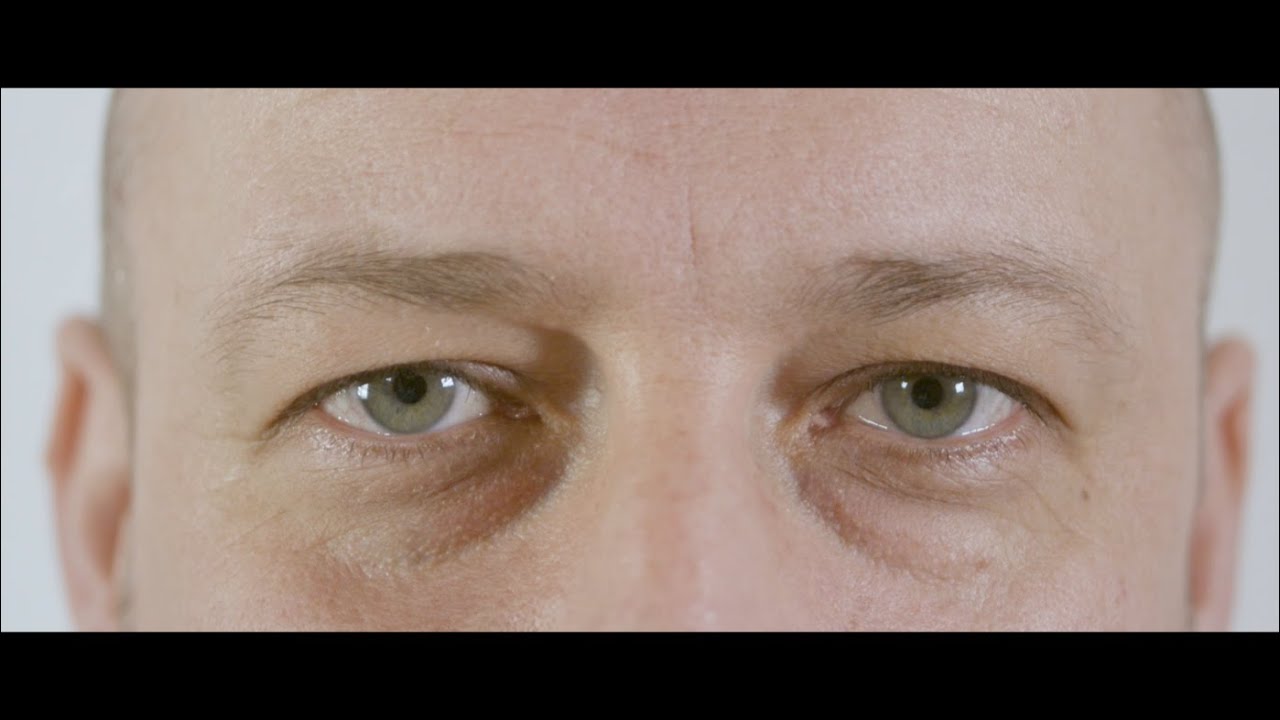 The patient perspective - YouTube