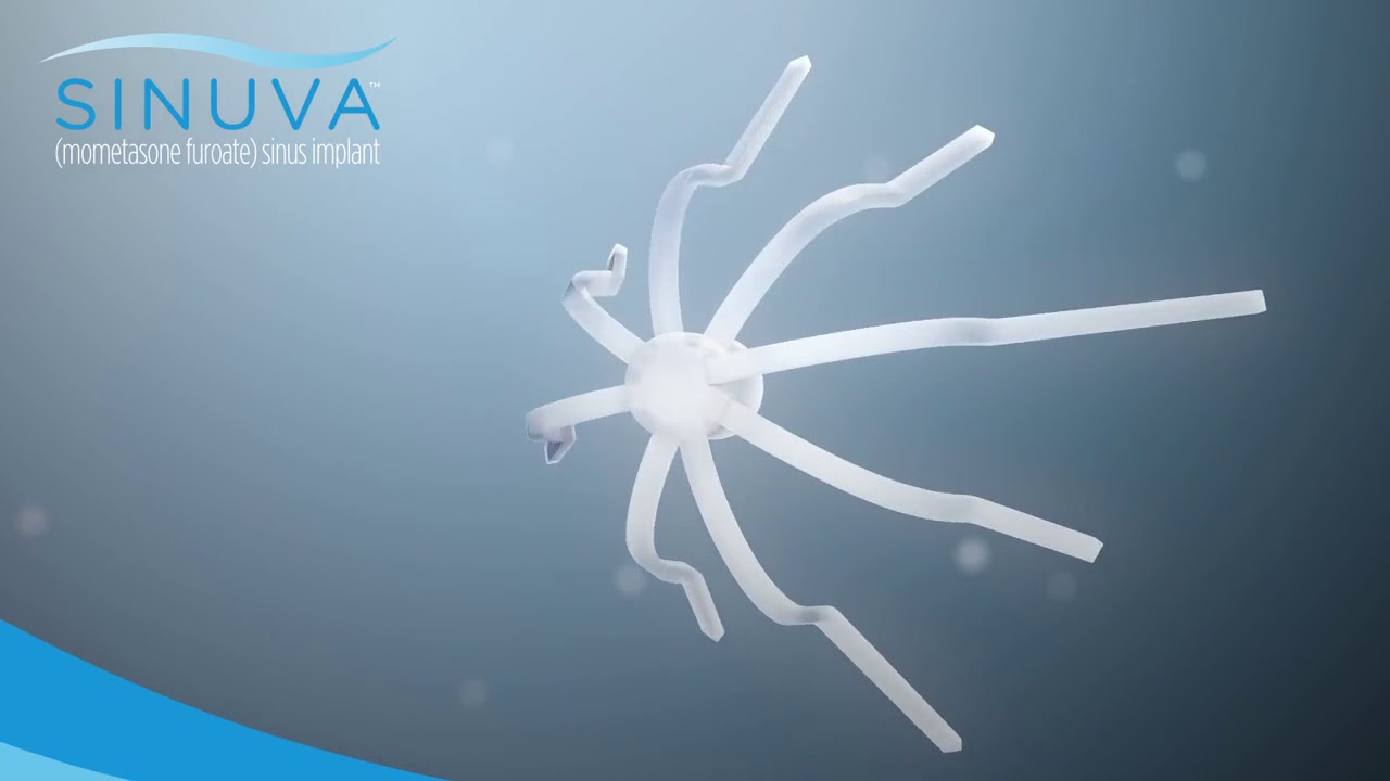 SINUVA Sinus Implant - How it Works - YouTube