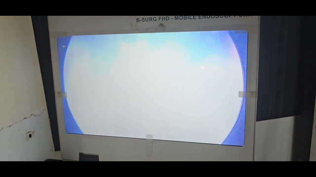 Mastoid cavity obliteration in mrm post op - Dr Hitesh Patel - YouTube