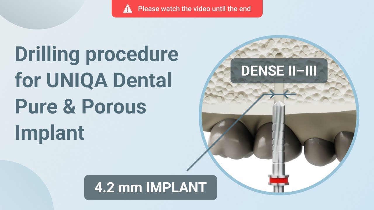 Drilling procedure for UNIQA Dental Pure & Porous Implant UH8 UV11 [ 4. ...