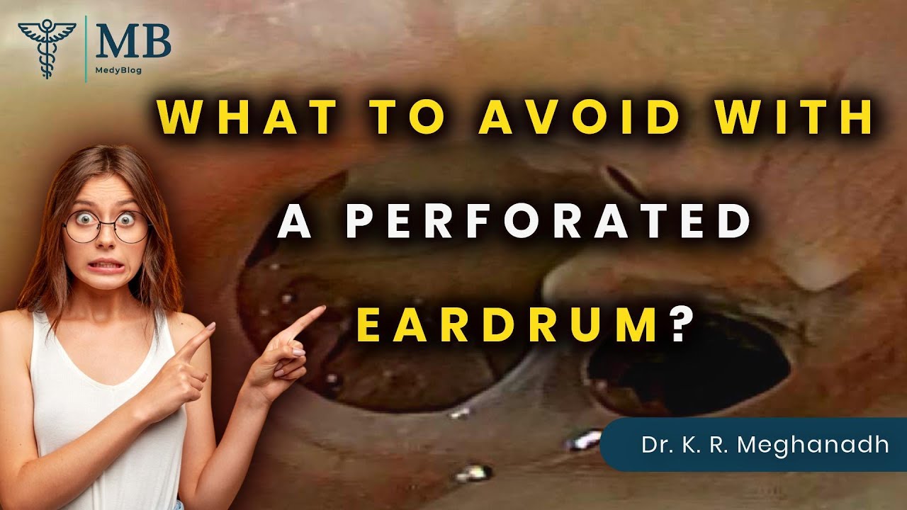 What to Avoid with a Perforated Eardrum|Dr. K. R. Meghanadh| Medyblog ...