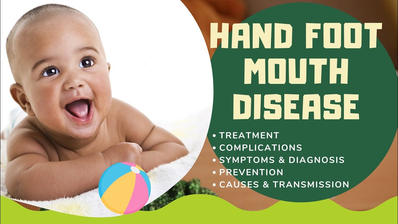 Hand Foot Mouth Disease in Infants & Toddlers | HFMD In Kids | Skin ...