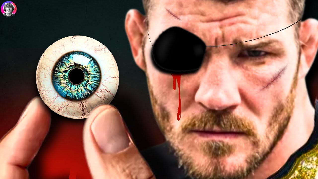 How an MMA Fighter With One Eye Became a UFC Champion - YouTube