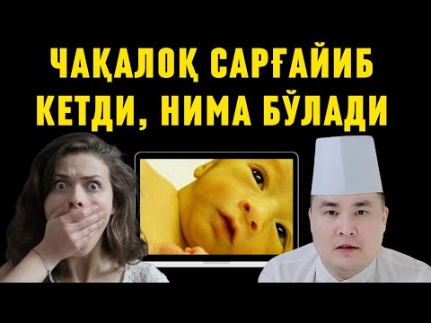 Чақалоқлар САРҒАЙСА, бу хавфлими? ҲАМА ОТА-ОНАЛАР БИЛИШИ КЕРАК!