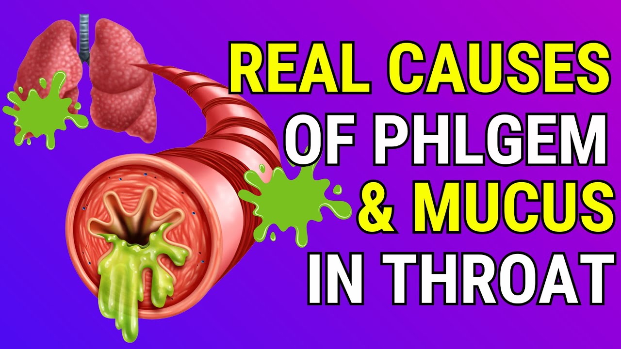 The Real Causes of Constant Phlegm and Mucus in Your Throat & How to ...