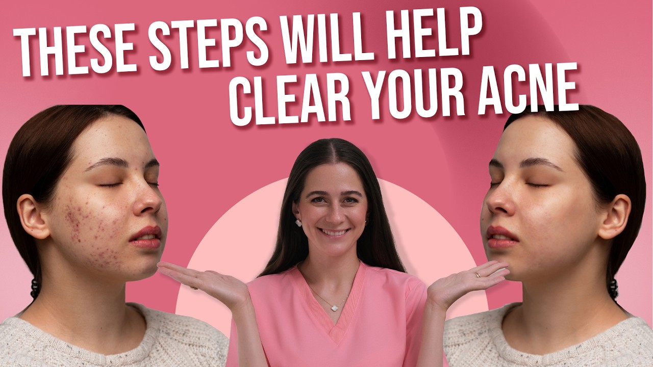 Acne Removal: What Really Works? | Acne Treatments & Clear Skin Plan ...