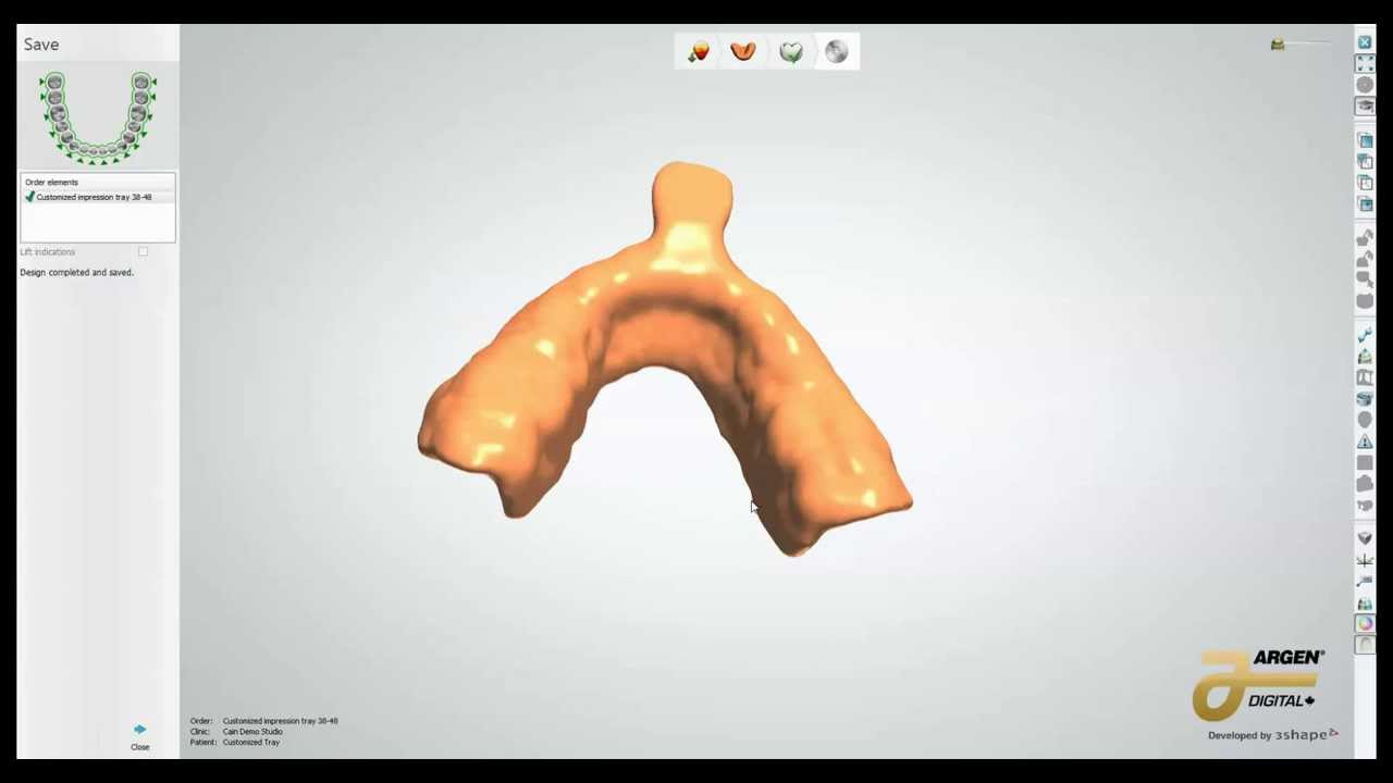 Customized Tray 2014 - YouTube