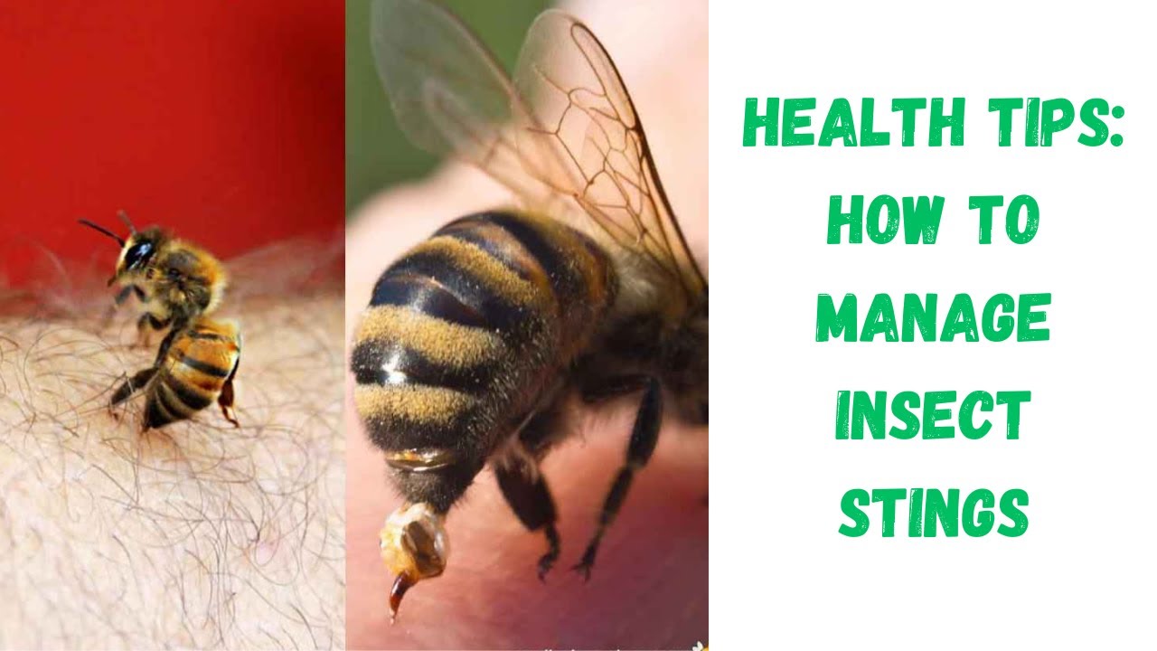 Insect Stings Prevention and Management - YouTube