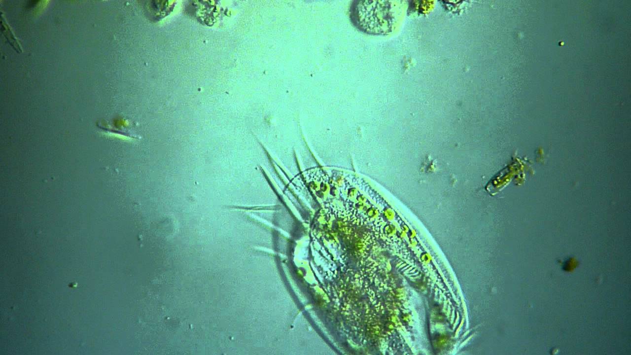 Euplotes sp 500X - YouTube