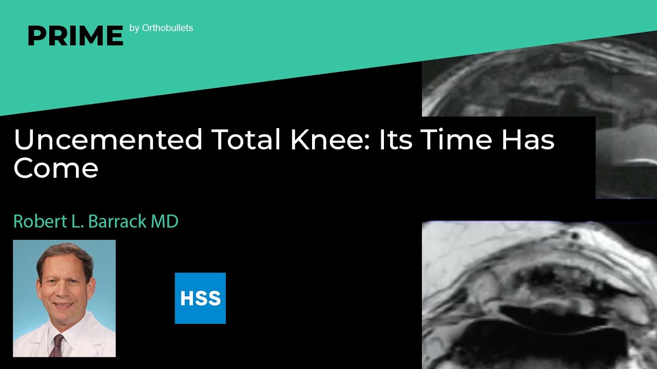 Uncemented Total Knee: Its Time Has Come - Robert L. Barrack MD - YouTube