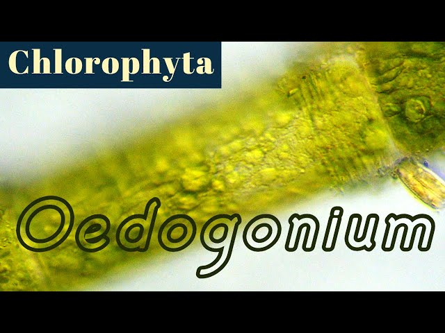 Phylum Chlorophyta Under Microscope
