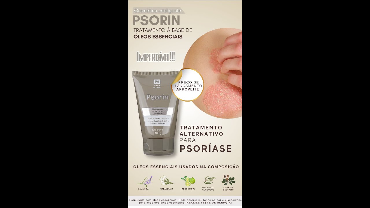 PSORÍASE: Saiba como tratar (Psorin) com Óleos Essenciais 🤍 - YouTube
